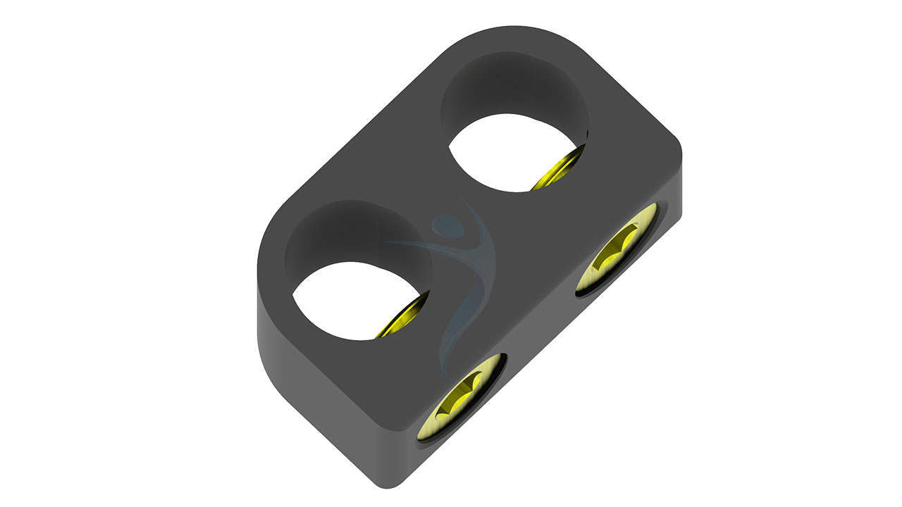 Pedicle Screw (MS-I) Spinal Fixation System